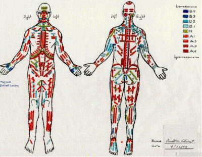 The Bodymap - A precise diagnostic tool for Psychotherapy - Bodynamic ...