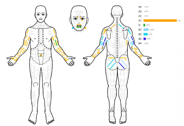 DEVELOPMENTAL TRAUMA FROM A BODYNAMIC PERSPECTIVE - Bodynamic International